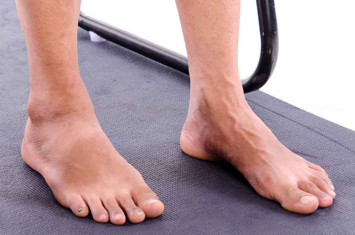 Great Toe Extension - Vissco Healthcare Private Limited.